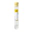 BD Vacutainer® Specialty Tubes - 364606 | BD