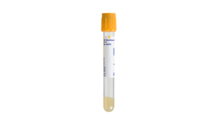 BD Vacutainer® SST™ Tubes - 367977 | BD