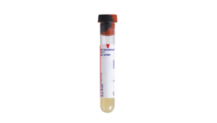 BD Vacutainer® SST™ Tubes - 367981 | BD