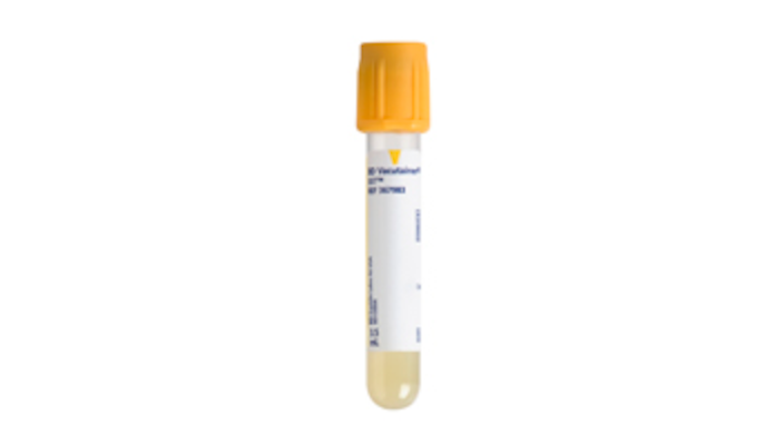 BD Vacutainer® SST™ Tubes - 367983 | BD