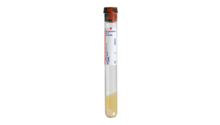 BD Vacutainer® SST™ Tubes - 367985 | BD