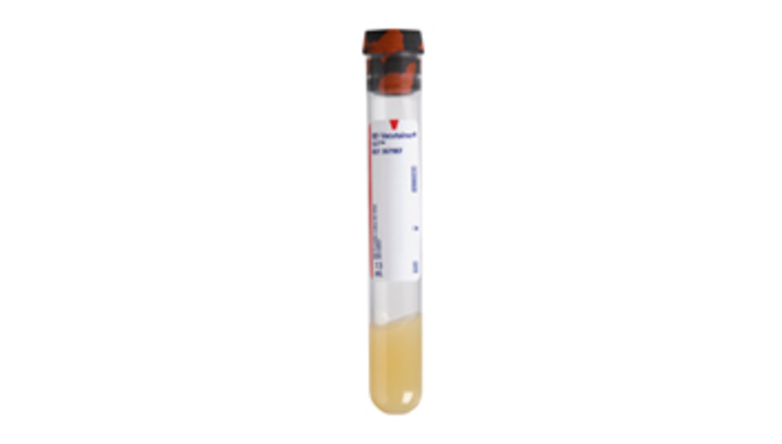 BD Vacutainer® SST™ Tubes - 367987 | BD