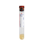 BD Vacutainer® SST™ Tubes - 367988 | BD