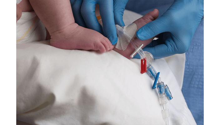 MaxZero™ Extension Set, Minibore Bifuse, 2 Bonded MaxZero™ Needle-Free ...