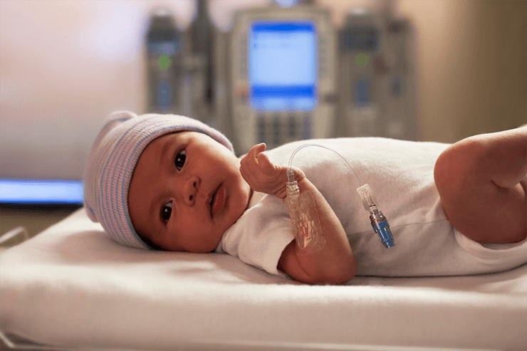 MaxZero™ extension set, minibore 1 MaxZero™ needle-free connector(s) 1. ...